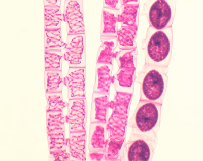Spirogyra conjugation, w.m. - Laboratory equipment