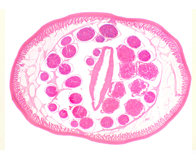 Ascaris male, c.s. - Laboratory equipment